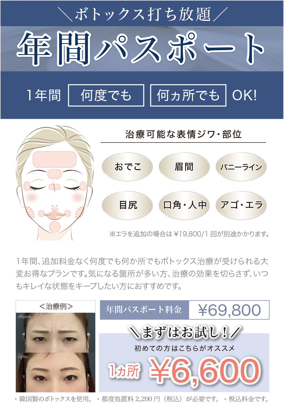 ボトックス（ボツリヌストキシン）注射 年間パスポート｜美容整形・美容外科｜銀座美容外科クリニック｜美容皮膚科・美容整形
